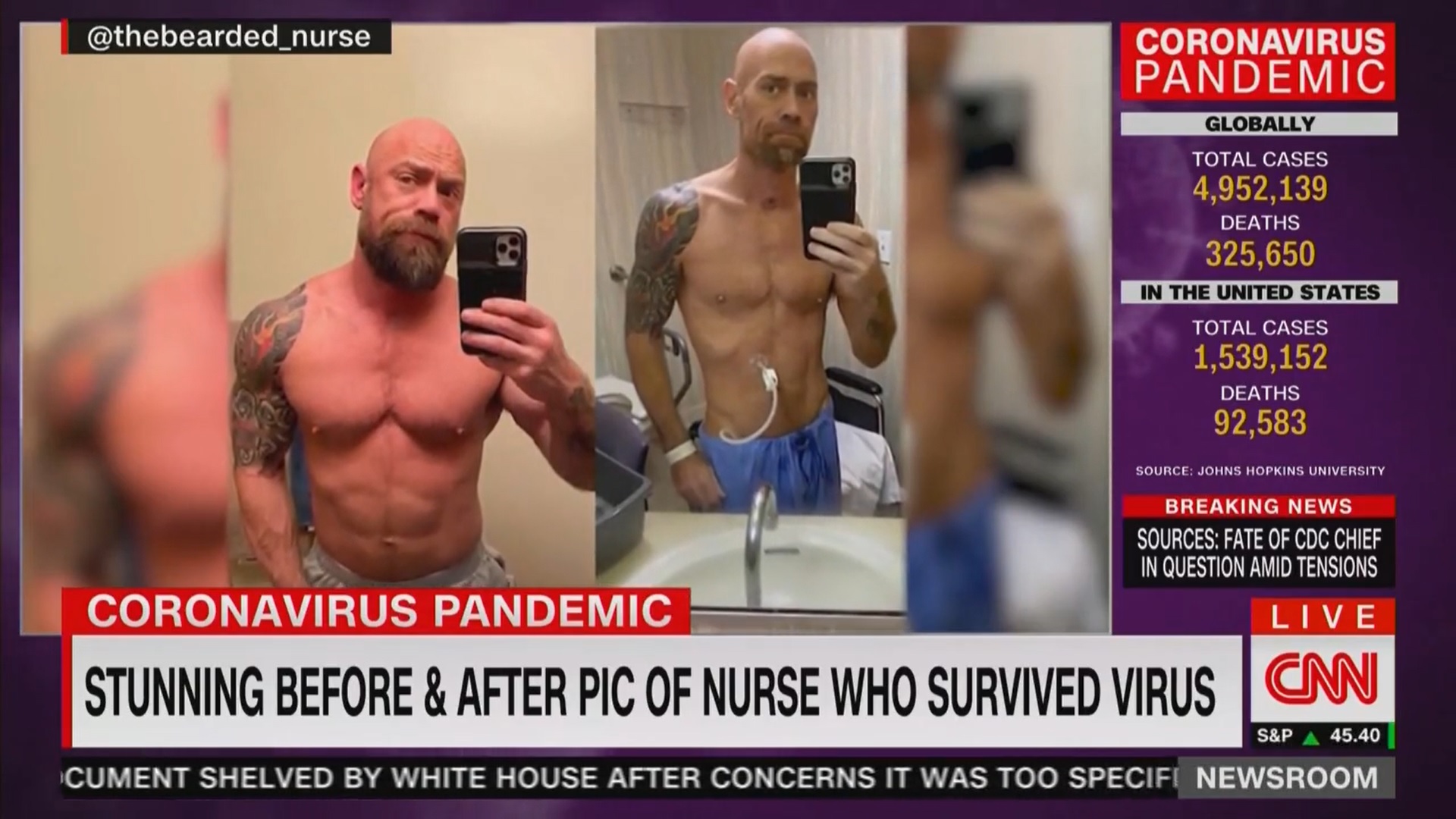 cnn-airs-shocking-photos-of-nurse-who-contracted-coronavirus